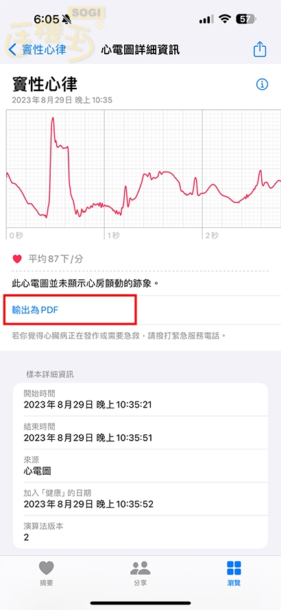 Apple Watch心電圖準確度如何？功能有用嗎？哪些人不適用一次看懂- SOGI 手機王